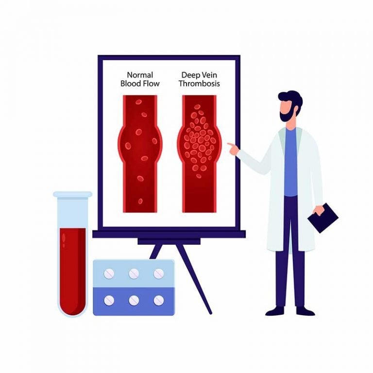 Deep Vein Thrombosis, a medical emergency. - OneHealth Hospital